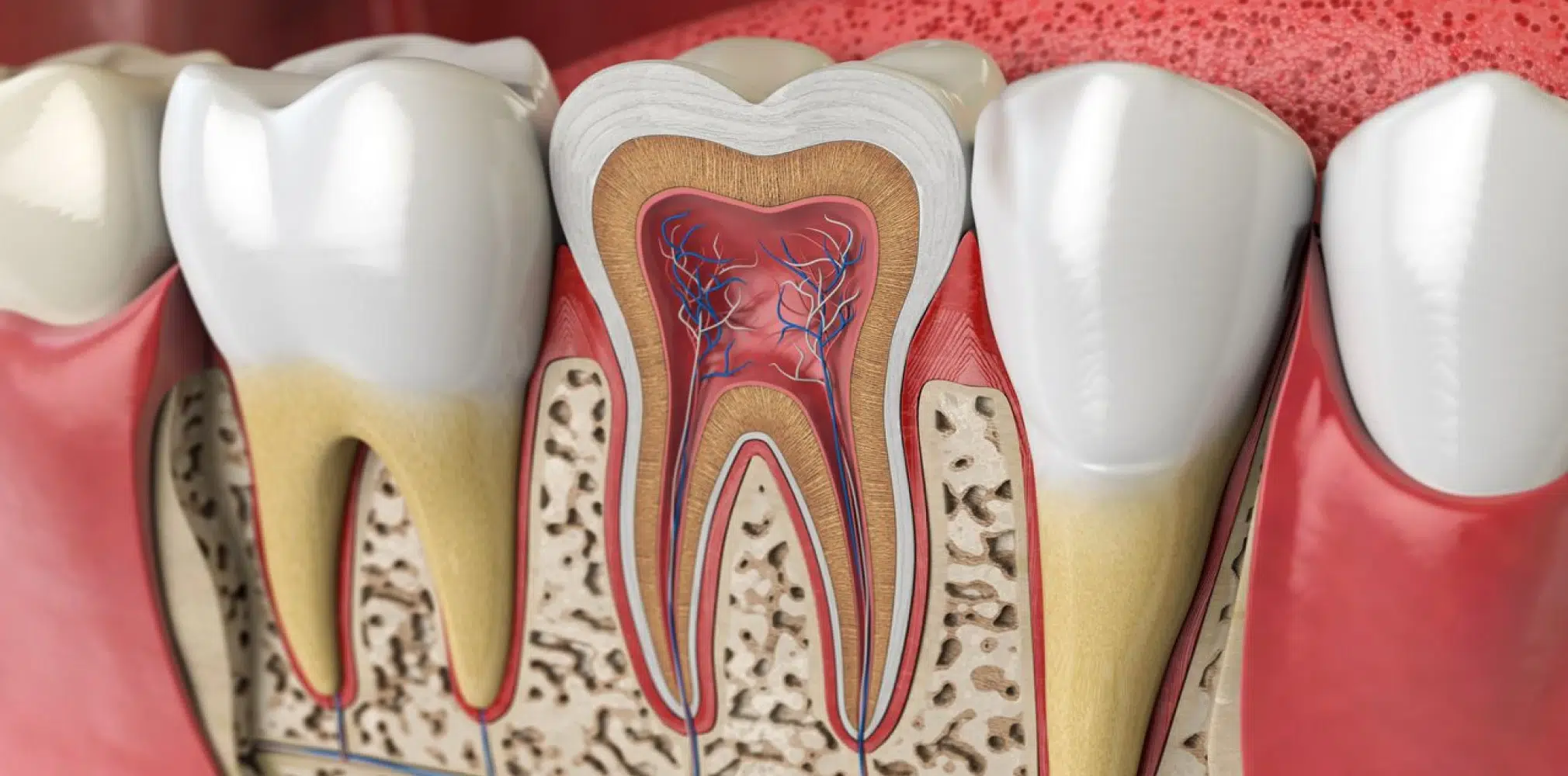 Résection apicale : quand la chirurgie devient incontournable pour ...
